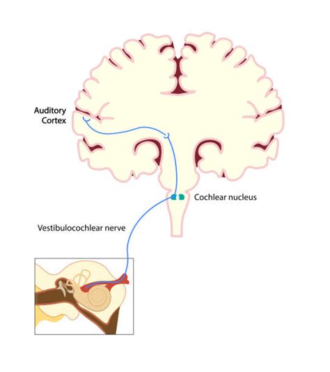 Cochlear Nerve Pathway