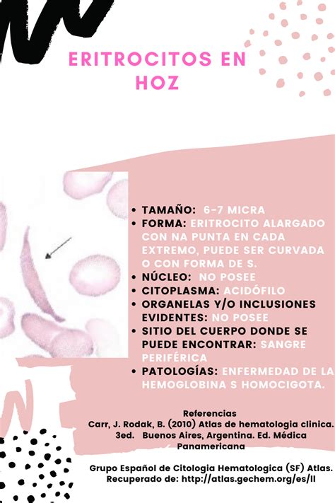 Pin De Ferchi Torres En Medicina ♥️ Eritrocitos Hematología Patologia