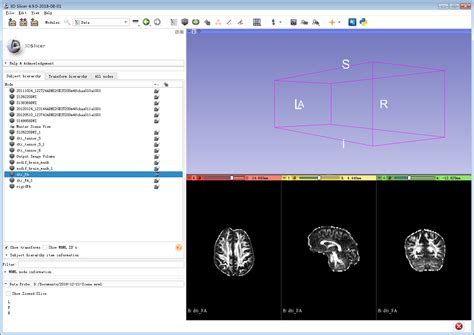 General Registration BRAINS 配准后图像不全 问题求助 3DSlicer中文论坛