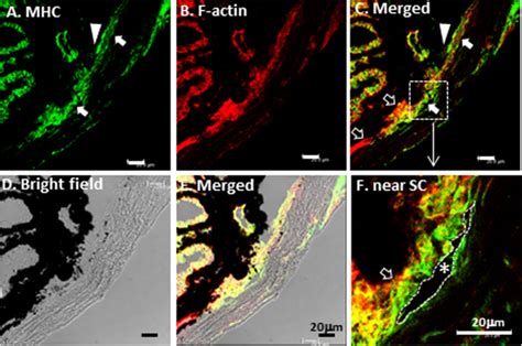 Non Muscle Myosin Heavy Chain Mhc And F Actin Immunolocalization In