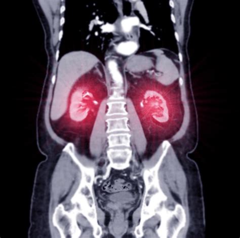 Abdominal Pelvic Ct Scan Over 47 Royalty Free Licensable Stock