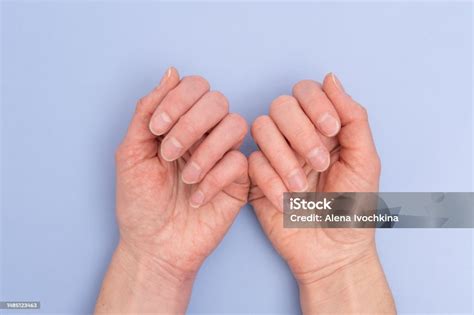 자연스러운 손톱을 가진 두 여성의 손을 클로즈업하고 파란색 배경에 자란 큐티클 손과 손톱 관리 손톱에 대한 스톡 사진 및 기타 이미지 Istock