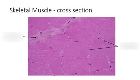 Skeletal Muscle Cross Section 33 Diagram Quizlet