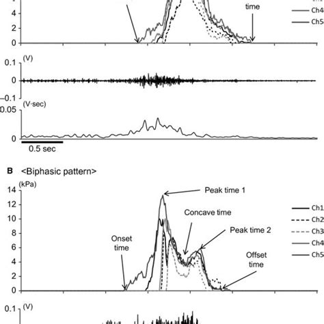 Sample Of Tongue Pressure And Emg With Monophasic And Biphasic Peak Download Scientific Diagram