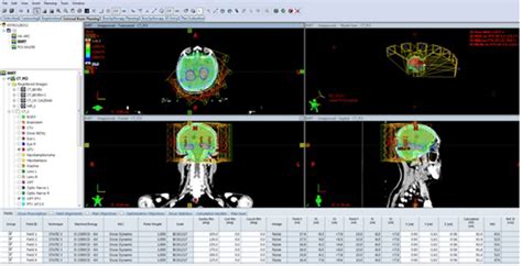 Typical Isodose Distribution Of Imrt Plans Download Scientific Diagram