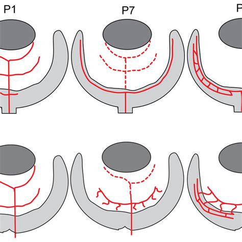 A Schematic Drawing Of Retinal Vascular Development Download