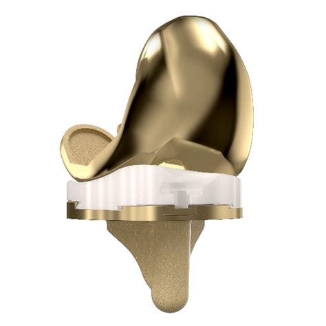 Microport Orthopedics Launches Evolution Nitrx Medial Pivot Knee