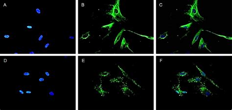 Immunocytochemistry Of Rpe Cells Indicating Rpe Cell Identity And