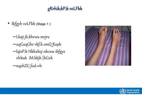 Filaria Stages In Marathippt