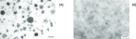 Transmission Electron Microscopy Micrographs Of A Normal Milk And B