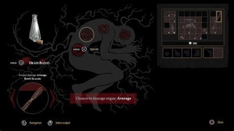 Pathologic 2 (PS4) REVIEW - Plague-Ridden - Cultured Vultures