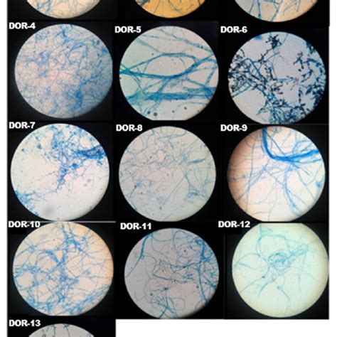 Microscopic View Of All Fungal Isolates Microscopic Characterization