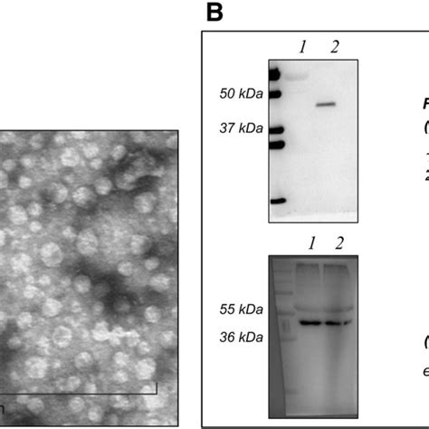 Exosome Size And Protein Content Characterization Showed That Sirna
