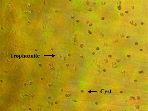 Microscopic Image 10 X Magnification Of Acanthamoeba Trophozoites And
