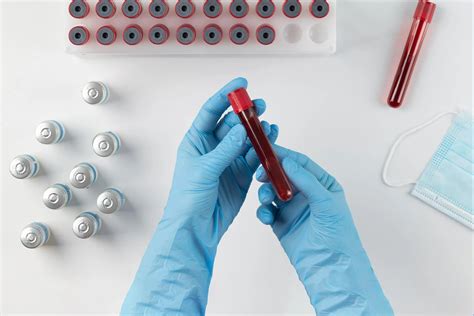 Rdw Blood Test Normal Range Test Uses Causes Of High Rdw
