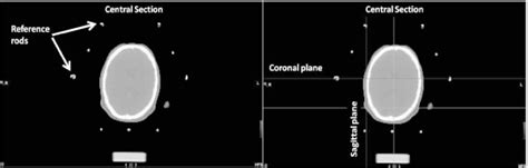 Ct Central Section Of The Localizer Illustrating The Reference Rods Download Scientific Diagram