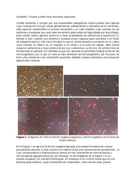 Informe Tinta China Y Foulton Pdf Las Bacterias Tinción