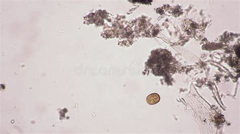 Infusoria Under Microscope Magnification In Fresh Water Stock Video