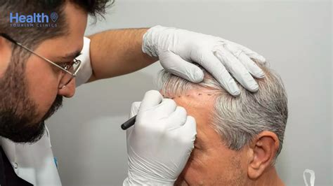 Which Are The Best Dhi Hair Transplant Clinics