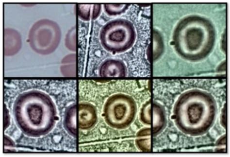 Image Augmentation Top Left Original Image Top Center To Bottom