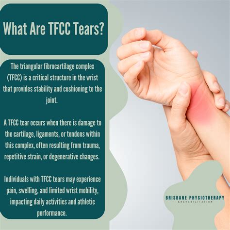 Tfcc Tear Triangular Fibrocartilage Complex Symptoms Treatment Rehab Exercises Brisbane