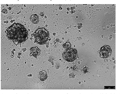 Figure 1 From Cellular And Genetic Background Of Osteosarcoma