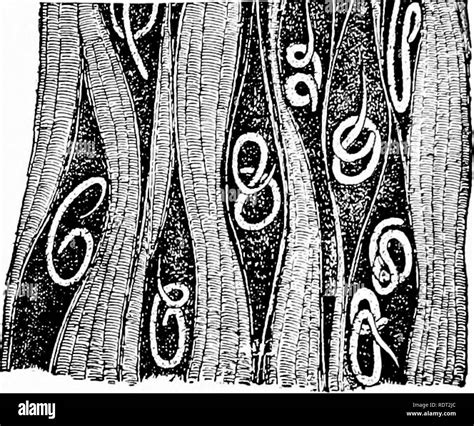 Trichinella Spiralis Encysted Larvae Labelled
