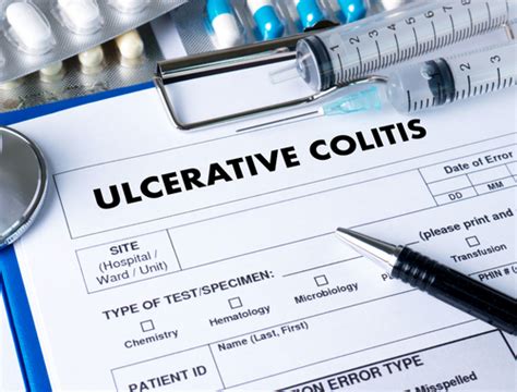 Difference Between Ulcerative Colitis And Diverticulitis Difference