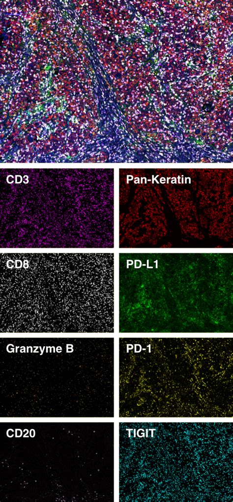 Signalstar™ Spatial Profiling Cell Signaling Technology