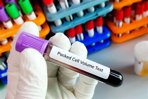PCV Test Normal Range Result Preparation And Procedure