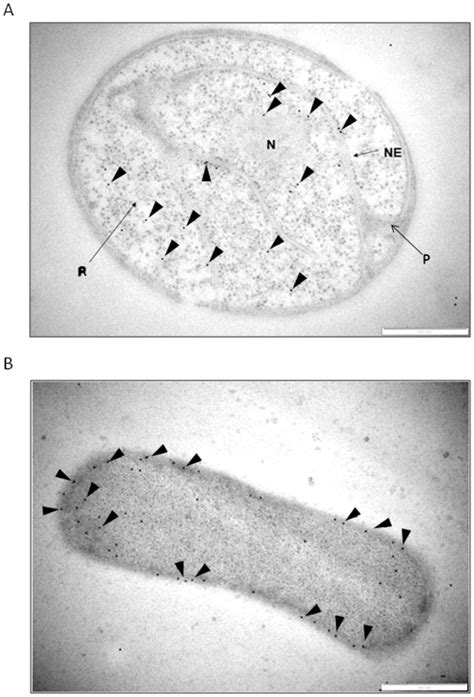 Immunogold Labelling Was Performed On High Pressure Frozen