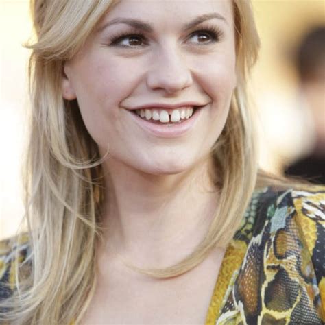 Lara Stone Teeth Fixed