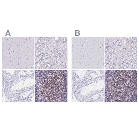 Rabbit Polyclonal Anti Ikzf1 Antibody Buy For Research Highly