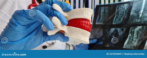 Closeup Of Therapist Holding An Anatomical Model Of Vertebrae With