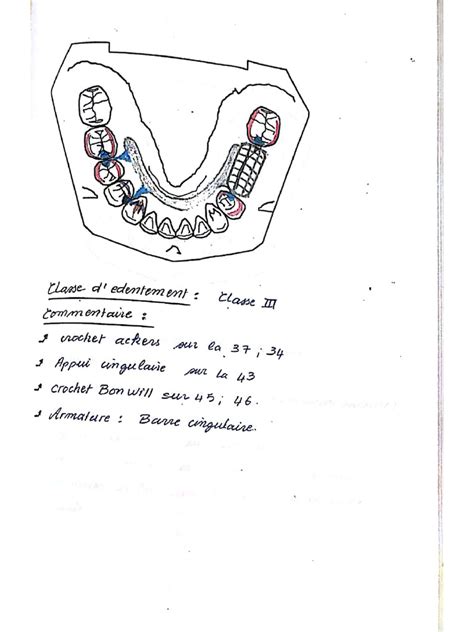 TracÉ Des Chassis Papm2304071124551 Pdf