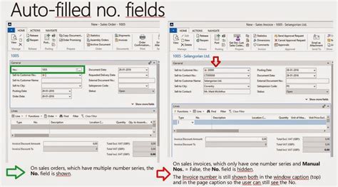 NAV 2015 New Feature UI Element Removal II