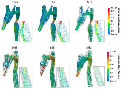 Streamlines Of The Flow Computed With Cfd Simulations Of The Aorta