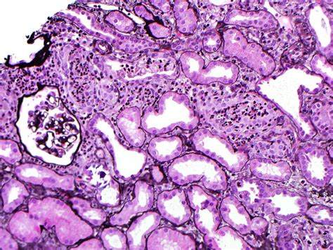 Renal Pathology Society Home Facebook