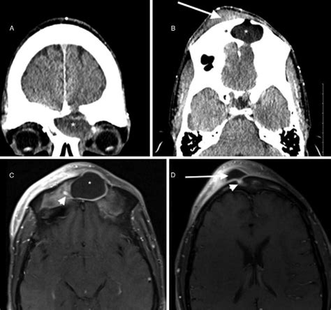 Imaging Performed At Initial Presentation A Ct Showing A Cystic Mass Download Scientific
