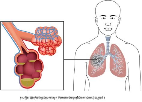 មាន ជំងឺ រលាក សួត ញ៉ាំ ប្រូតេអ៊ីន ច្រើន នឹង ឆាប់ ជា