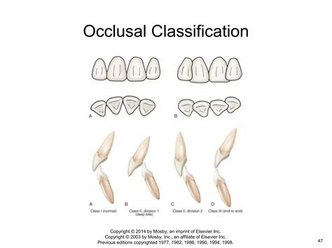 Basic Occlusion Ppt