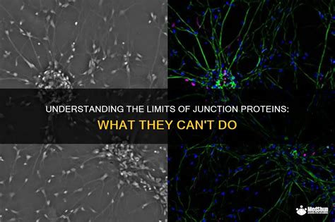 Understanding The Limits Of Junction Proteins What They Cant Do Medshun