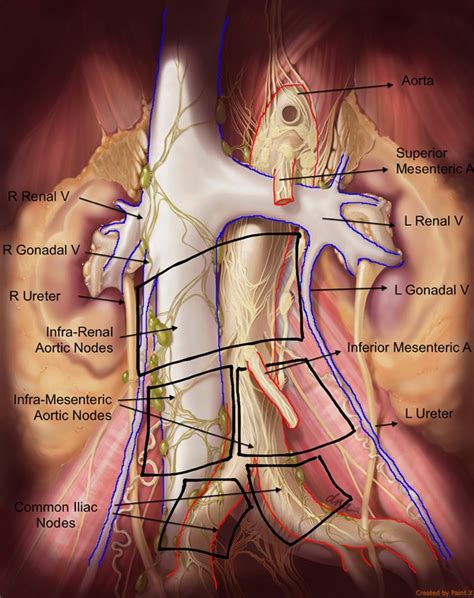 Para Aortic Lymph Nodes