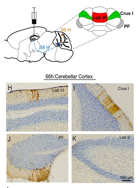 Biophilia What Does The Cerebellum Do