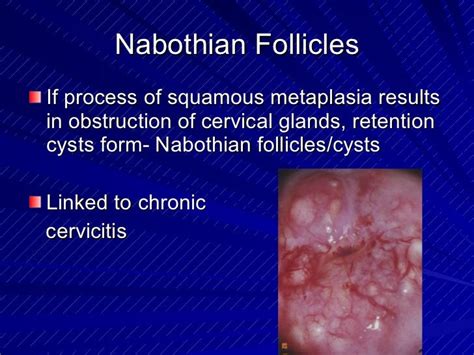 Are Vulvar Lesions Benign Melanocytic Lesions Of The Vulva Wpyo