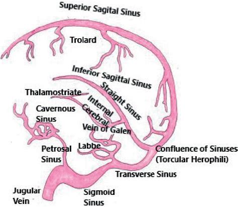 Figure 1 From Cerebral Venous Thrombosis A Clinical Overview