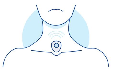 Automatic Heart Rate Detection During Sleep Using Tracheal Audio Recordings From Wireless