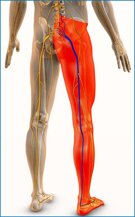 Sciatica Relief Causes Symptoms And Treatment Options