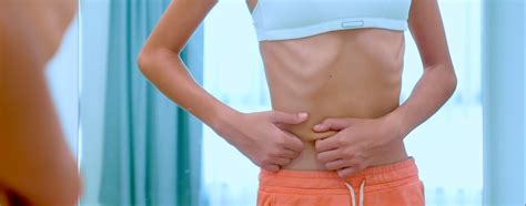 Anorexia Nervosa Conheça Este Problema
