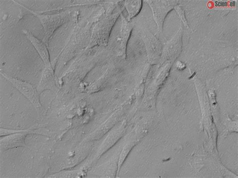 Human Aortic Fibroblasts